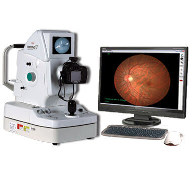 Eyecare Technology - Eye and I